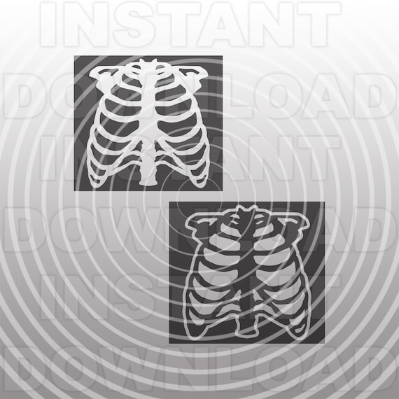 Chest X-ray SVG Filex-ray Tech Svgrad Tech Svgx-ray - Etsy
