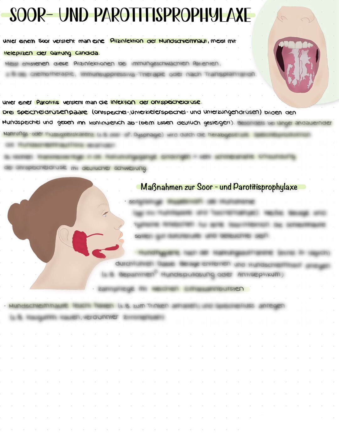 Study Sheet Thrush and Parotitis Prophylaxis - Etsy