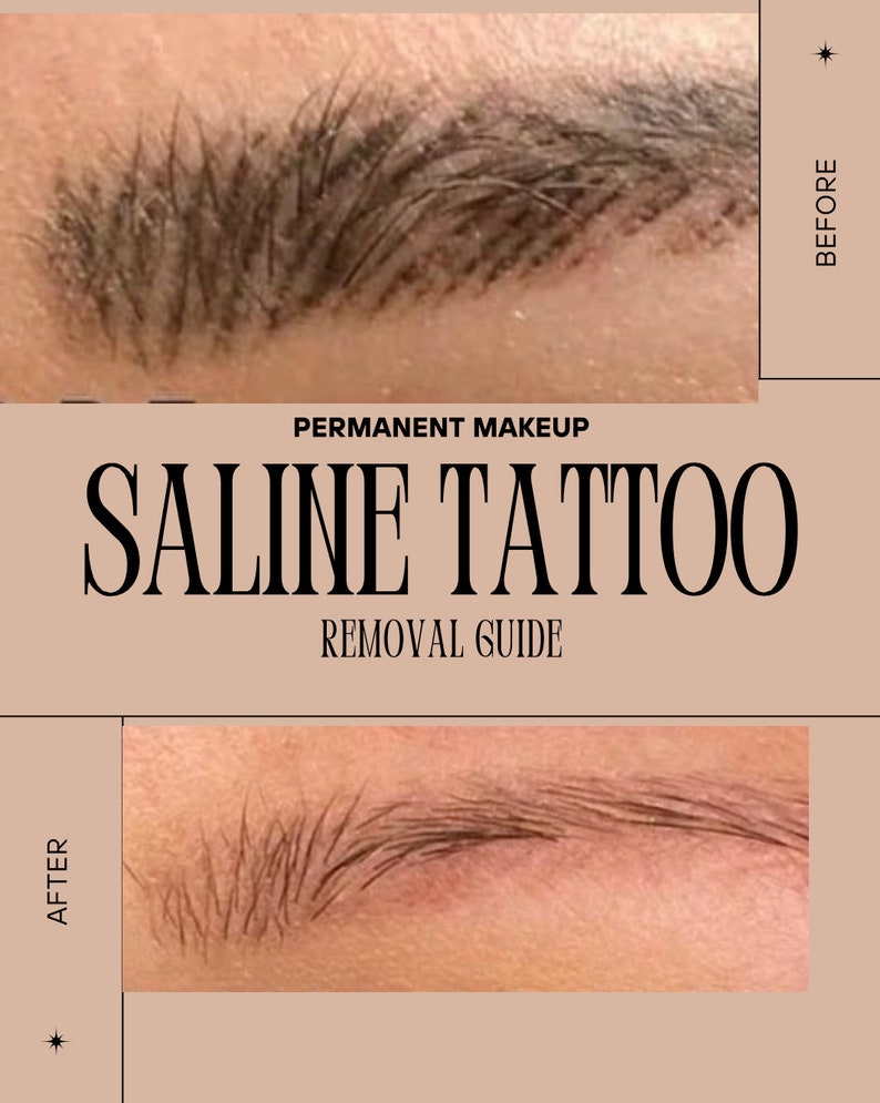 PMU Saline Tattoo Removal Guide - Etsy