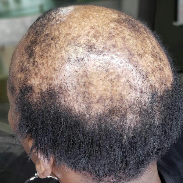 Nene Crack Hair Growth Oil - Etsy