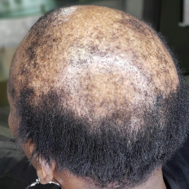 Nene Crack Hair Growth Oil - Etsy