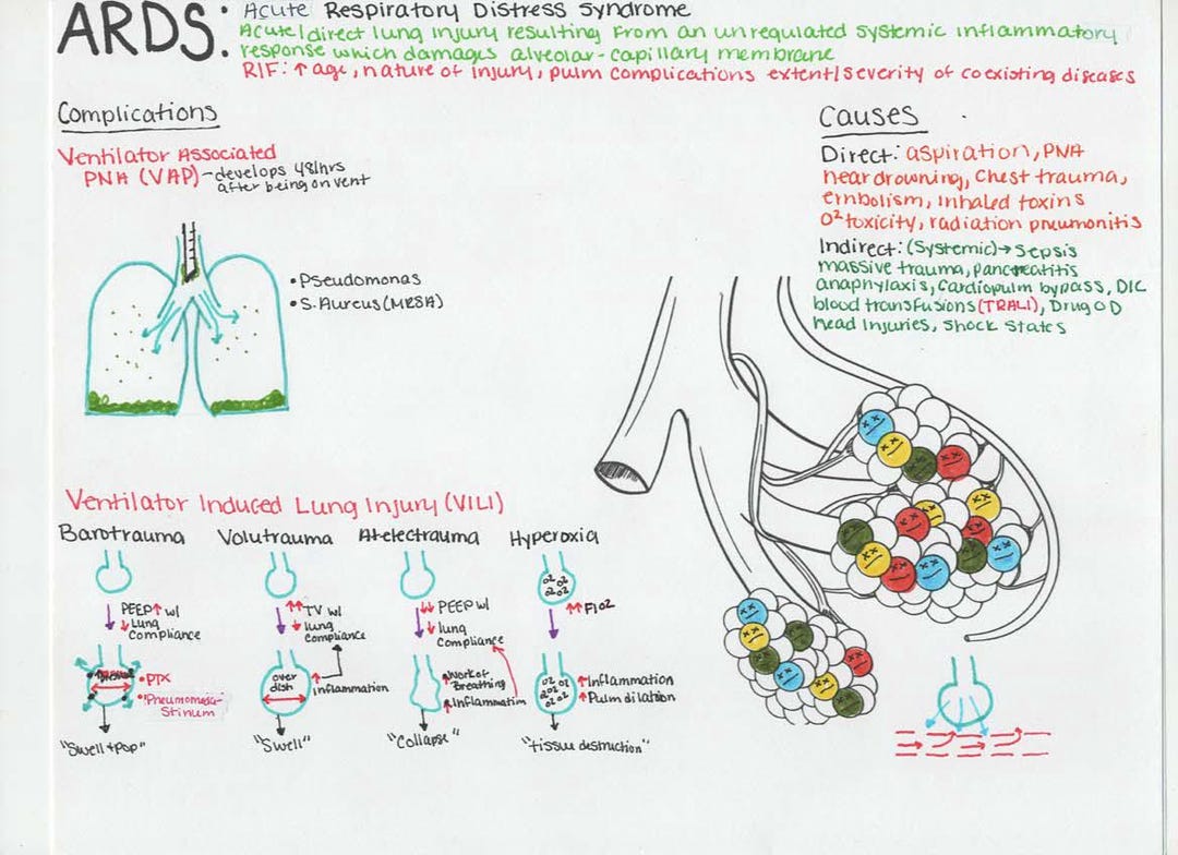 ARDS Concept Map & Doodle: Nursing Study Guide (PDF Download) - Etsy