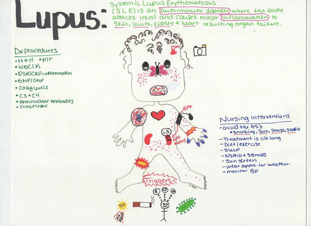 Lupus Nursing Study Guide: SLE Doodle & Concept Map (PDF Download - Etsy