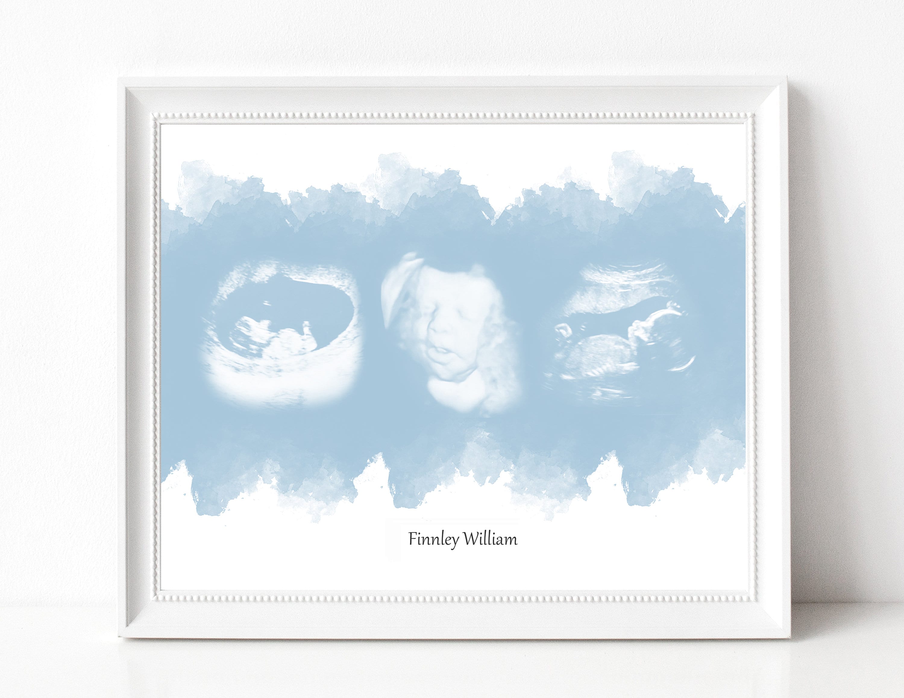 Baby Ultrasound Art Watercolor Sonogram Print Baby Shower | Etsy
