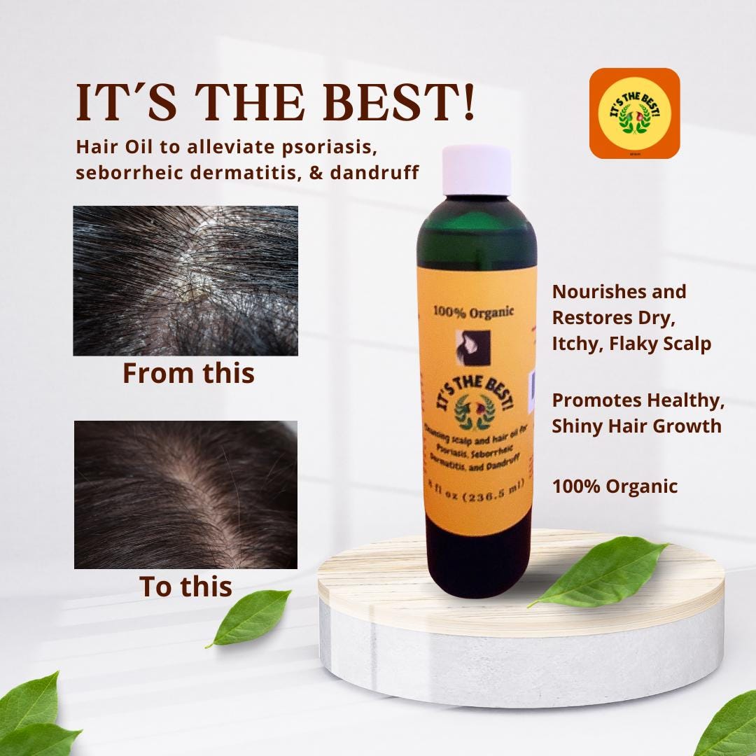 100% Organic Hair Oil to Alleviate Psoriasis, Seborrheic Dermatitis ...