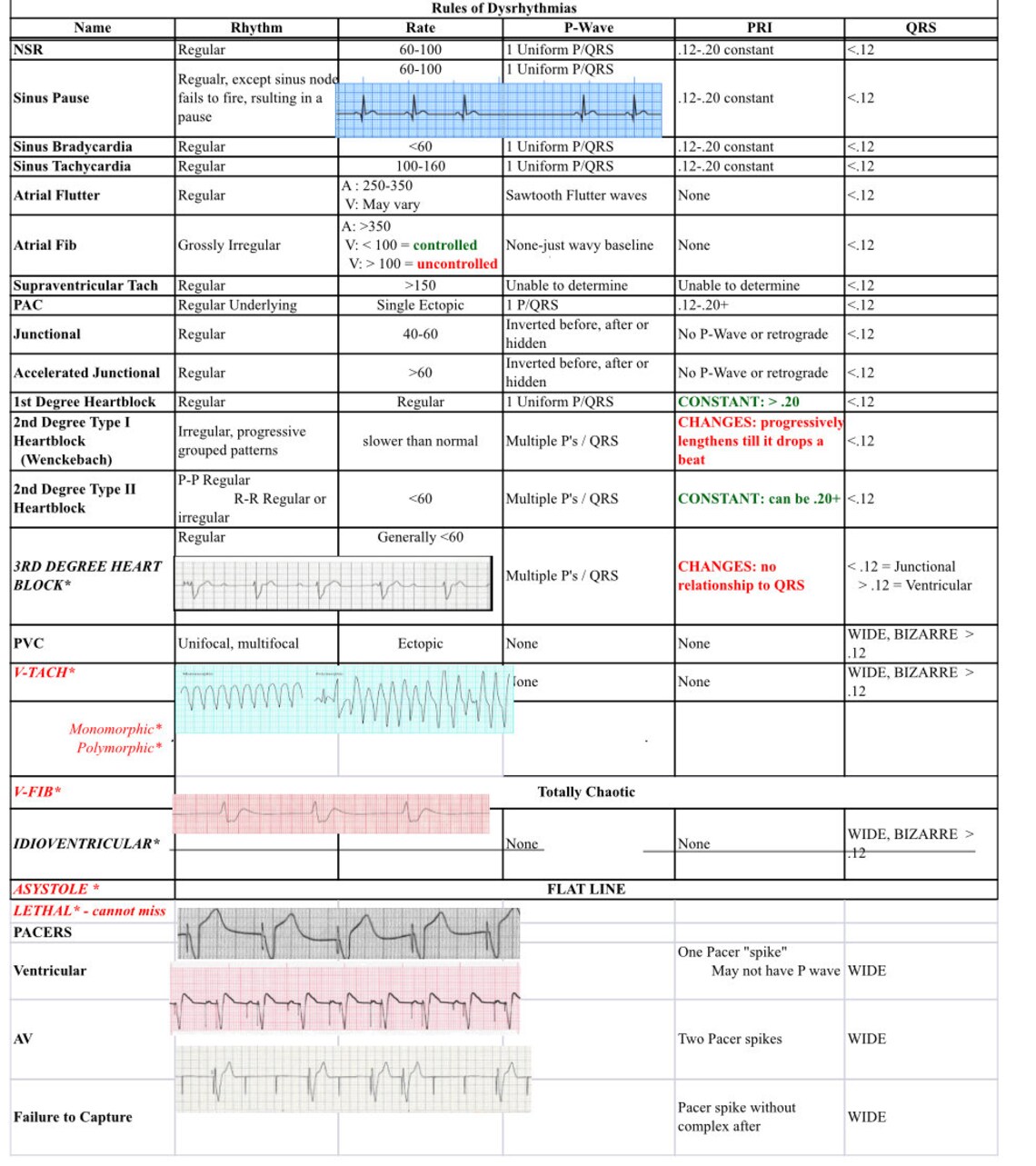 ECG Dysrhythmia Rules Cheat Sheet & Study Guide - Etsy