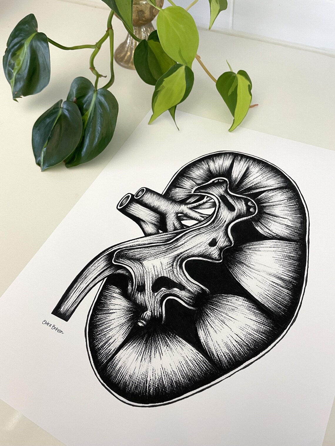 Human Kidney Fine Art Print .anatomy Drawing. Medical Poster. Urinary ...