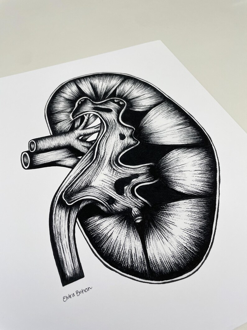 Human Kidney Fine Art Print .anatomy Drawing. Medical Poster. Urinary ...