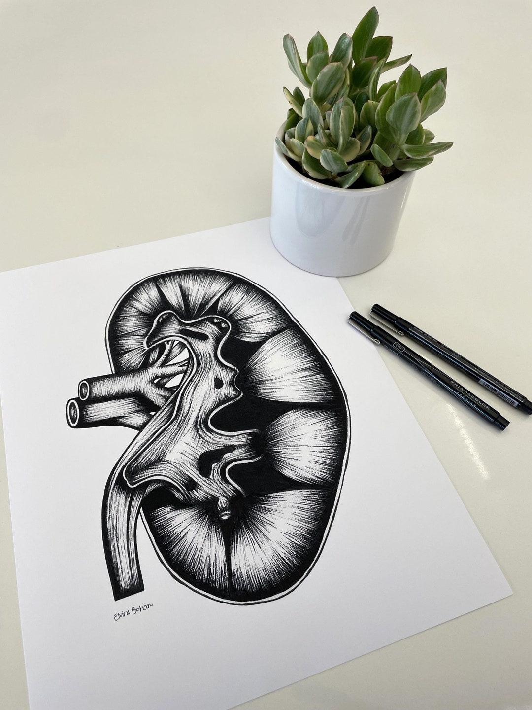 Human Kidney Fine Art Print .anatomy Drawing. Medical Poster. Urinary ...