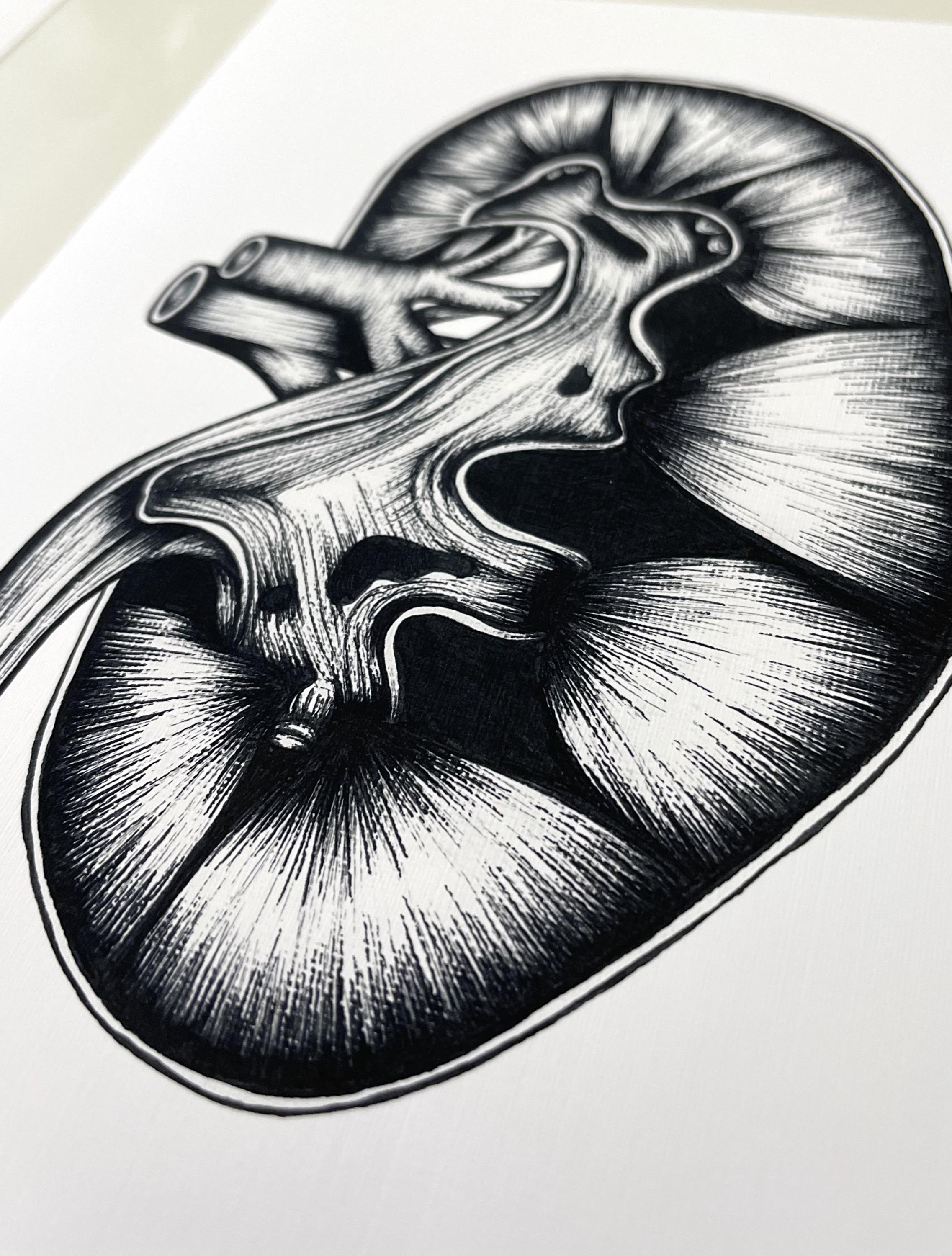 Human Kidney Fine Art Print .anatomy Drawing. Medical Poster. Urinary ...
