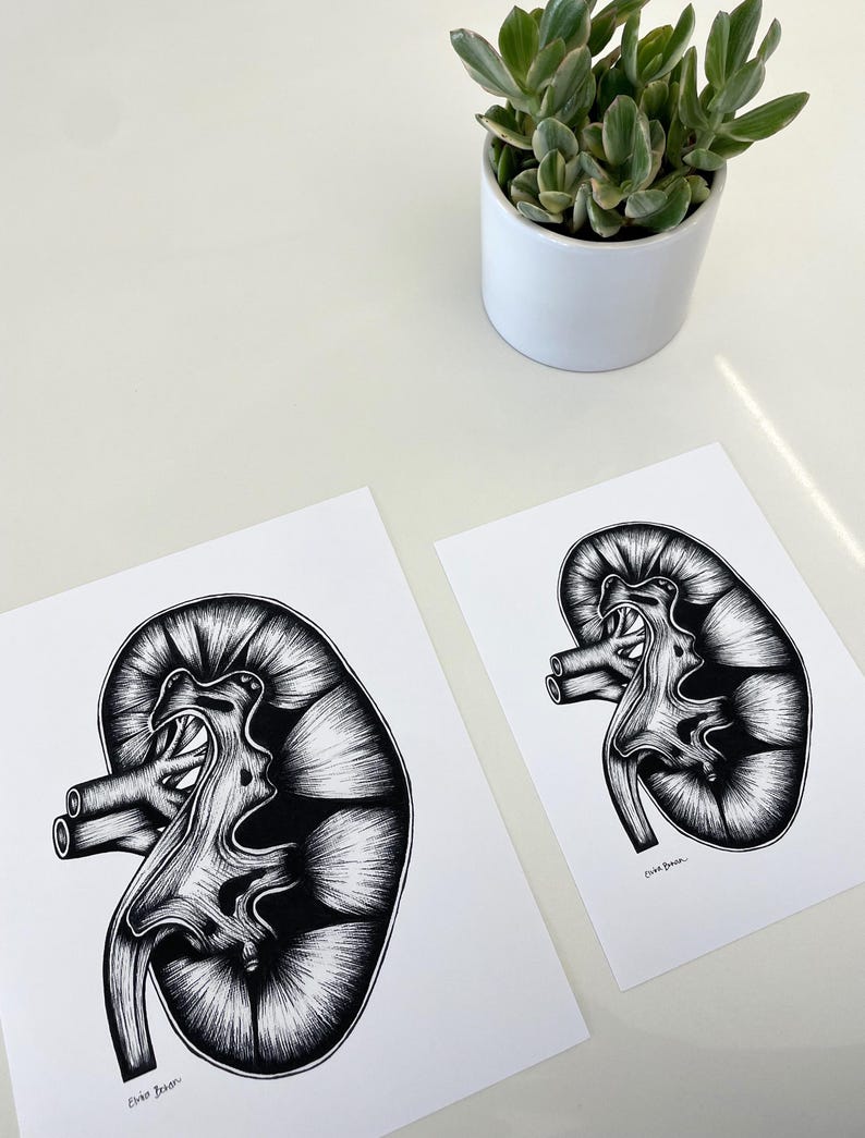 Human Kidney Fine Art Print .anatomy Drawing. Medical Poster. Urinary ...