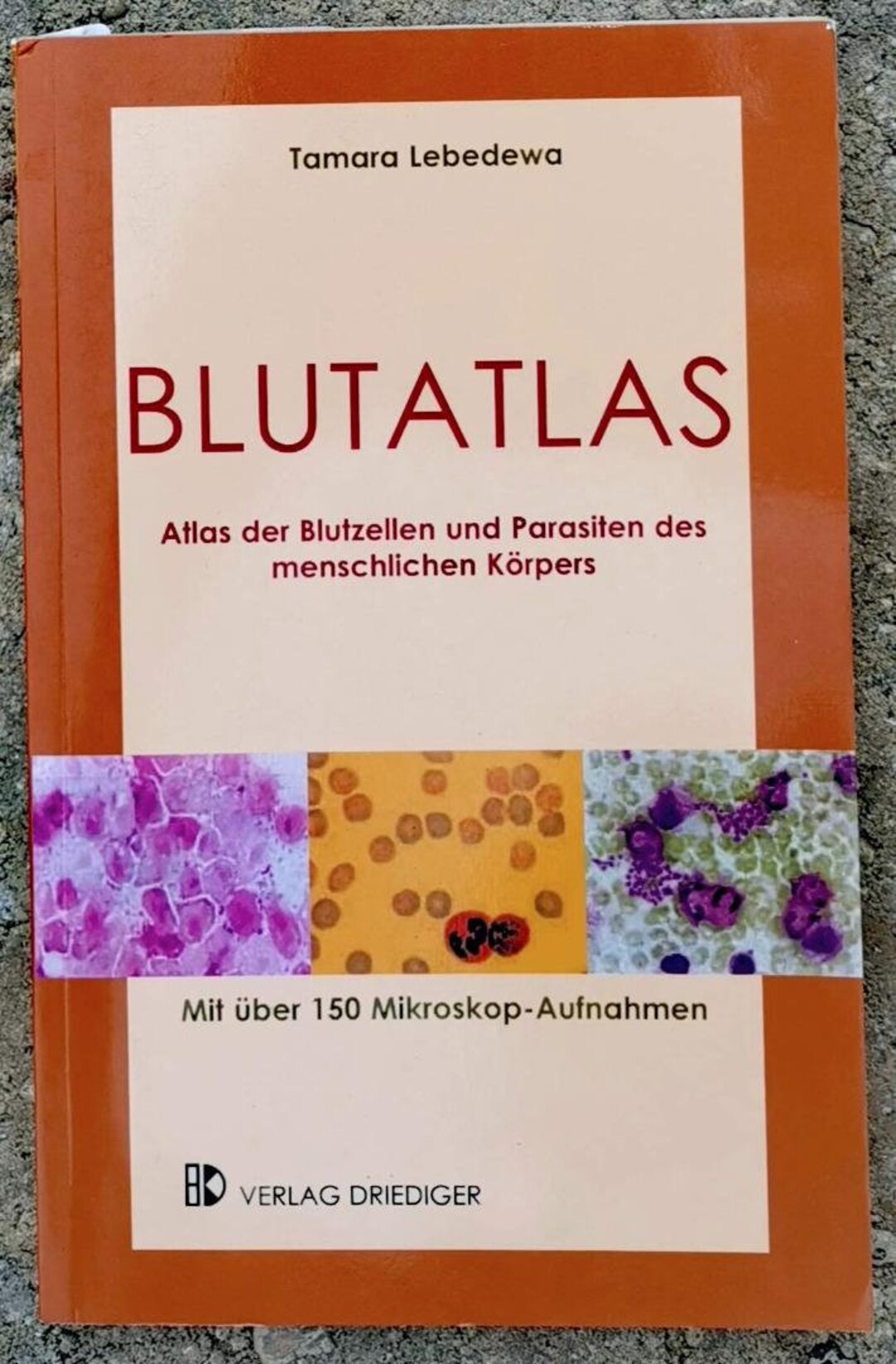 Blood Atlas: Atlas of Blood Cells and Parasites of the Human Body ...