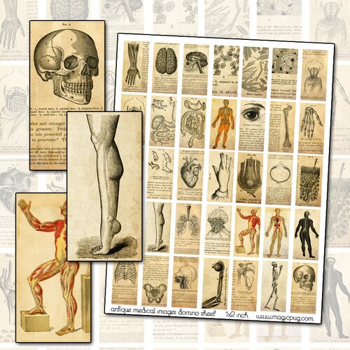 Antique Medical Engraving Domino Digital Collage Sheet For Etsy