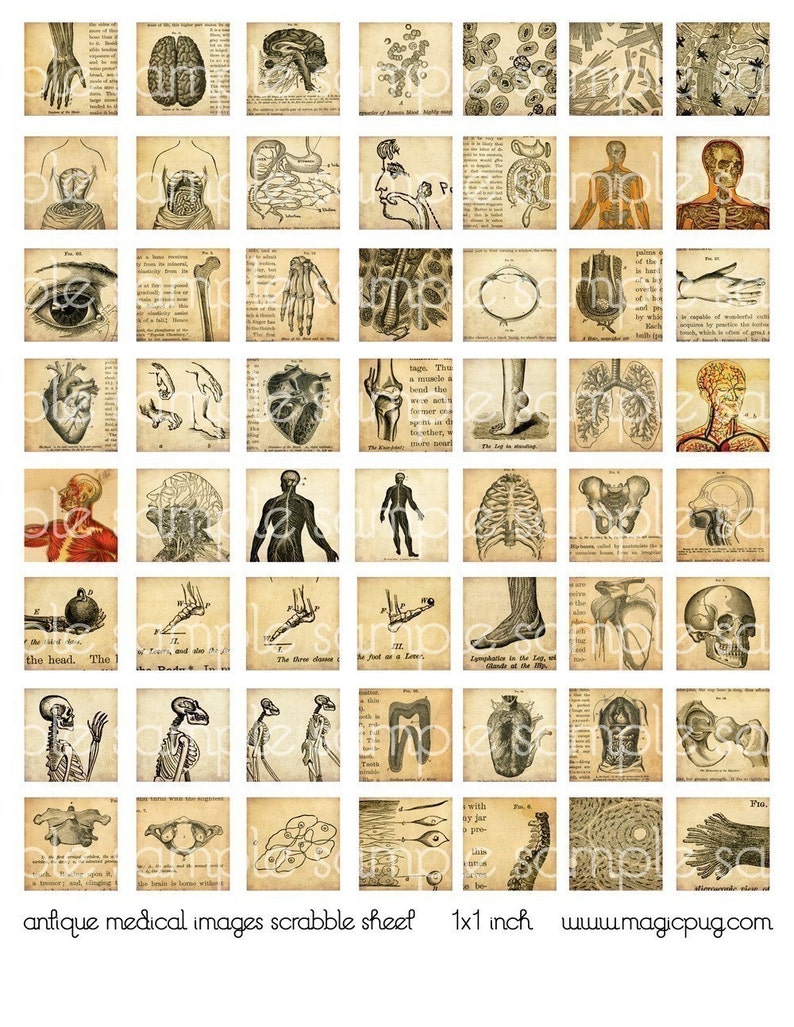 Antique Medical Engraving 1 Inch Square Digital Collage For Etsy