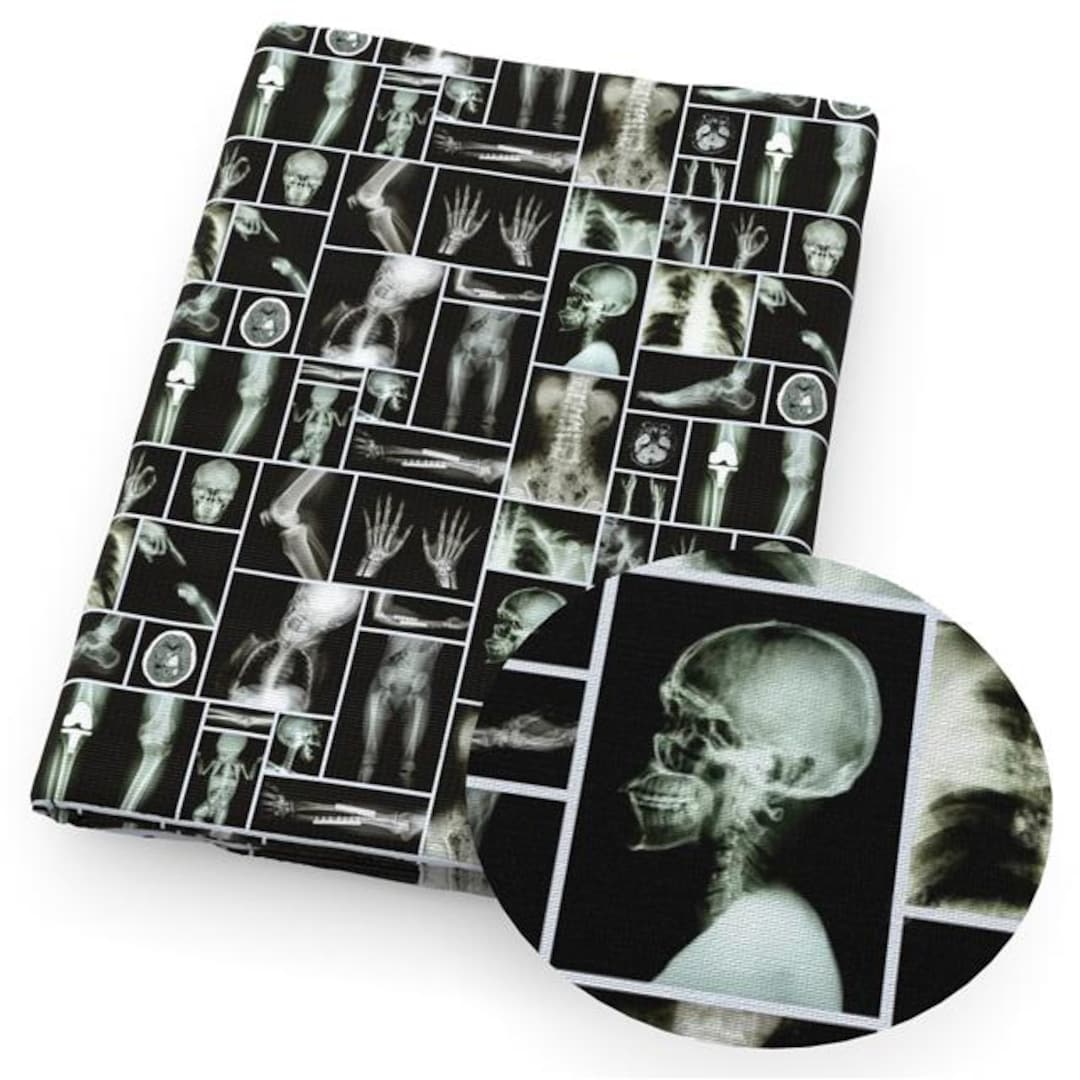 Human Body X Ray Fabric by the Yard - Etsy