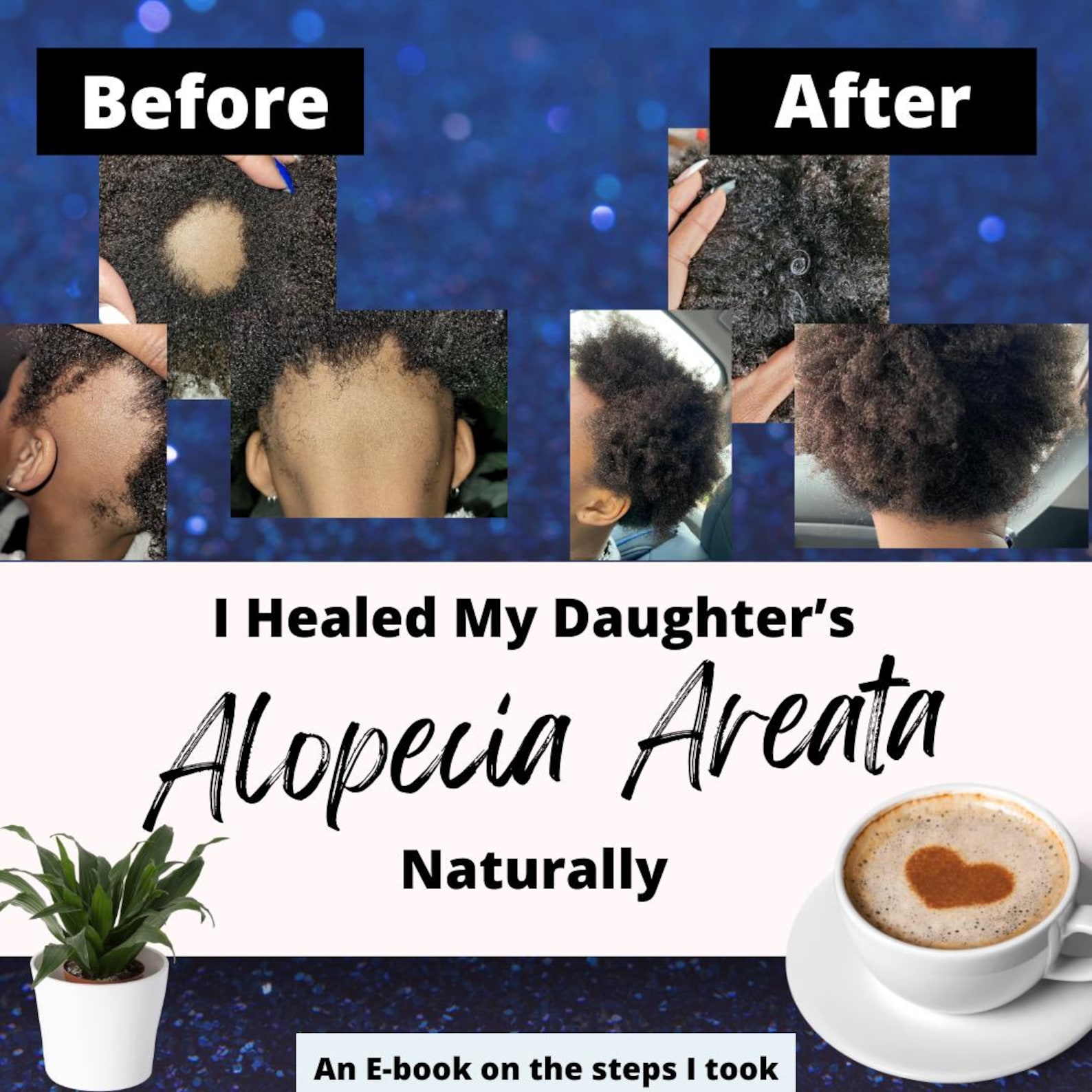 How I Healed My Daughters Alopecia Areata Naturally E-book With Live ...