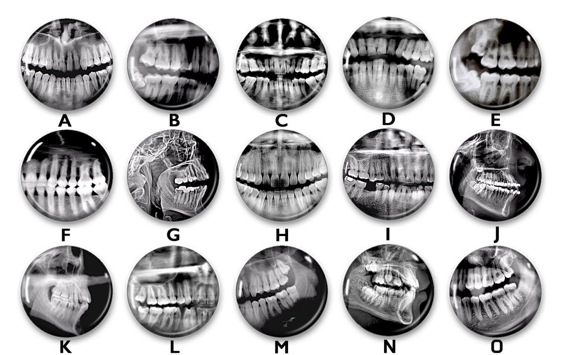 Dental Xray Coasters, Halloween, Goth, Drink Coasters, Button Coasters ...