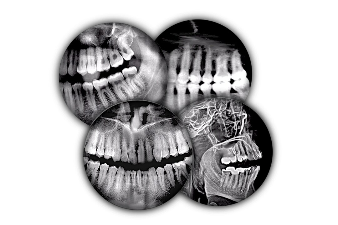 Dental Xray Coasters, Halloween, Goth, Drink Coasters, Button Coasters ...