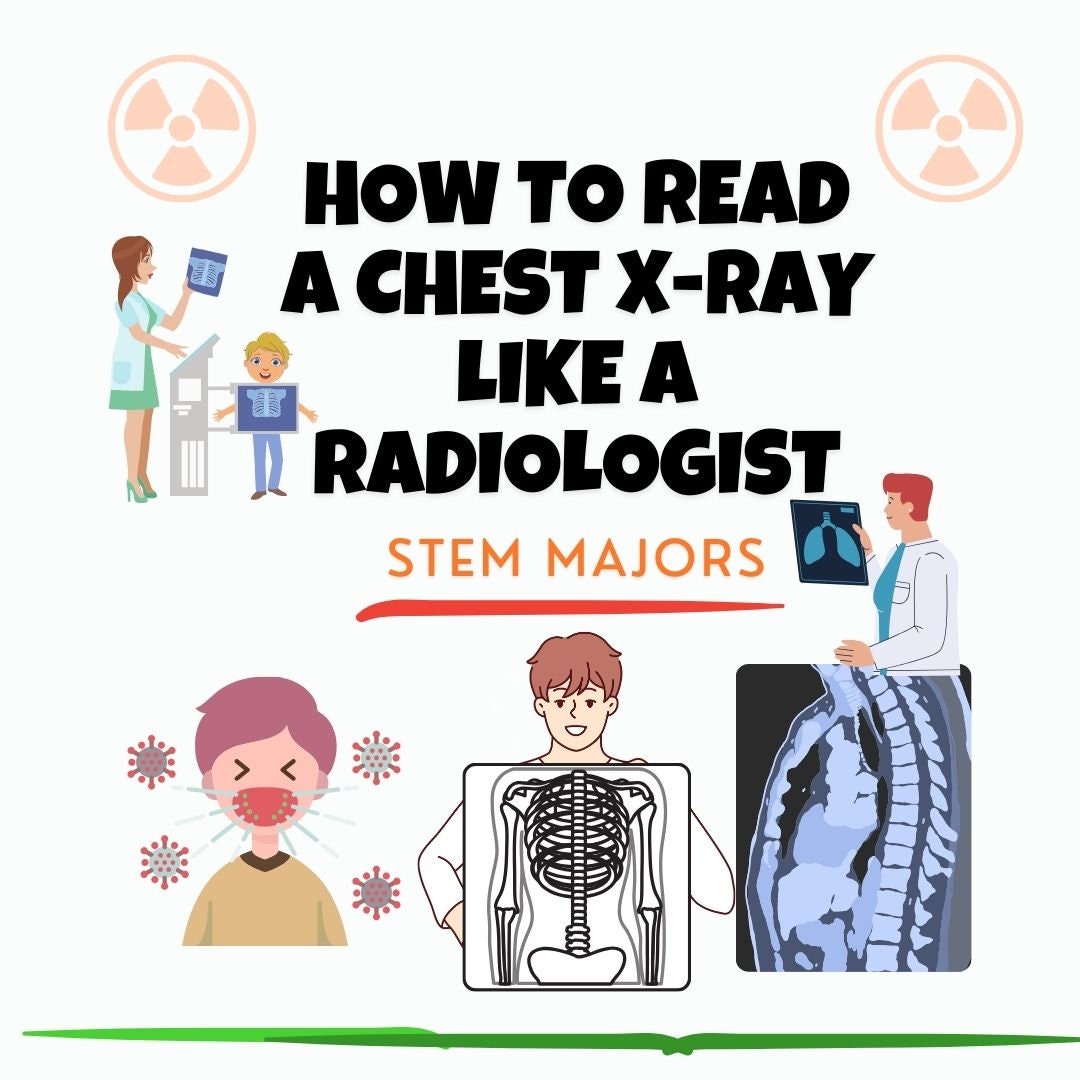 How to Read a Chest X-ray Just Like a Radiologist Physician STEM Majors ...