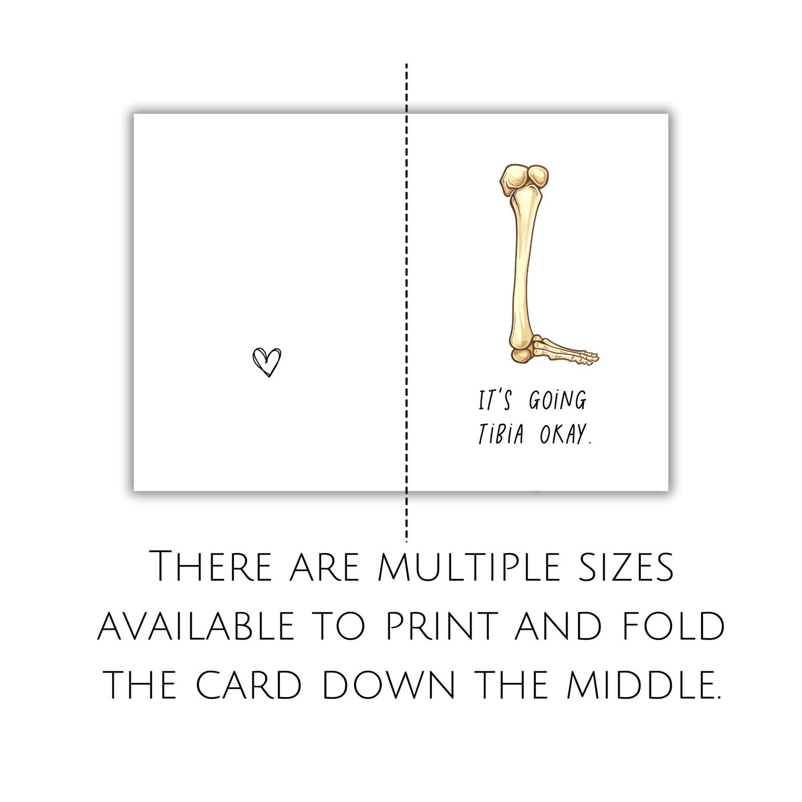Broken Leg Card Printable Funny Get Well Card It's Going Tibia Okay ...