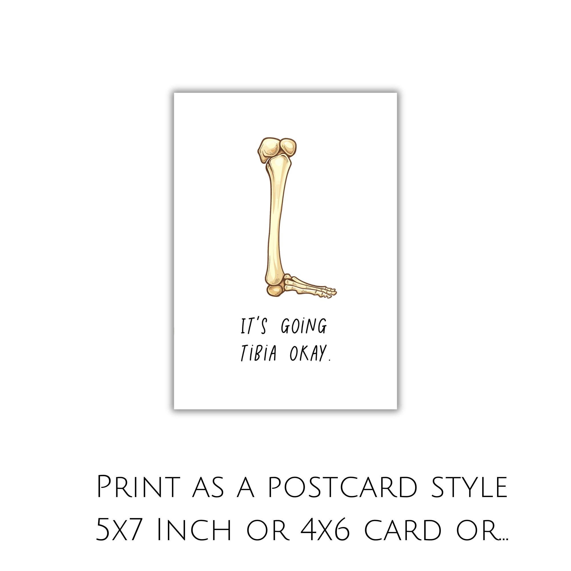 Broken Leg Card Printable Funny Get Well Card It's Going Tibia Okay ...