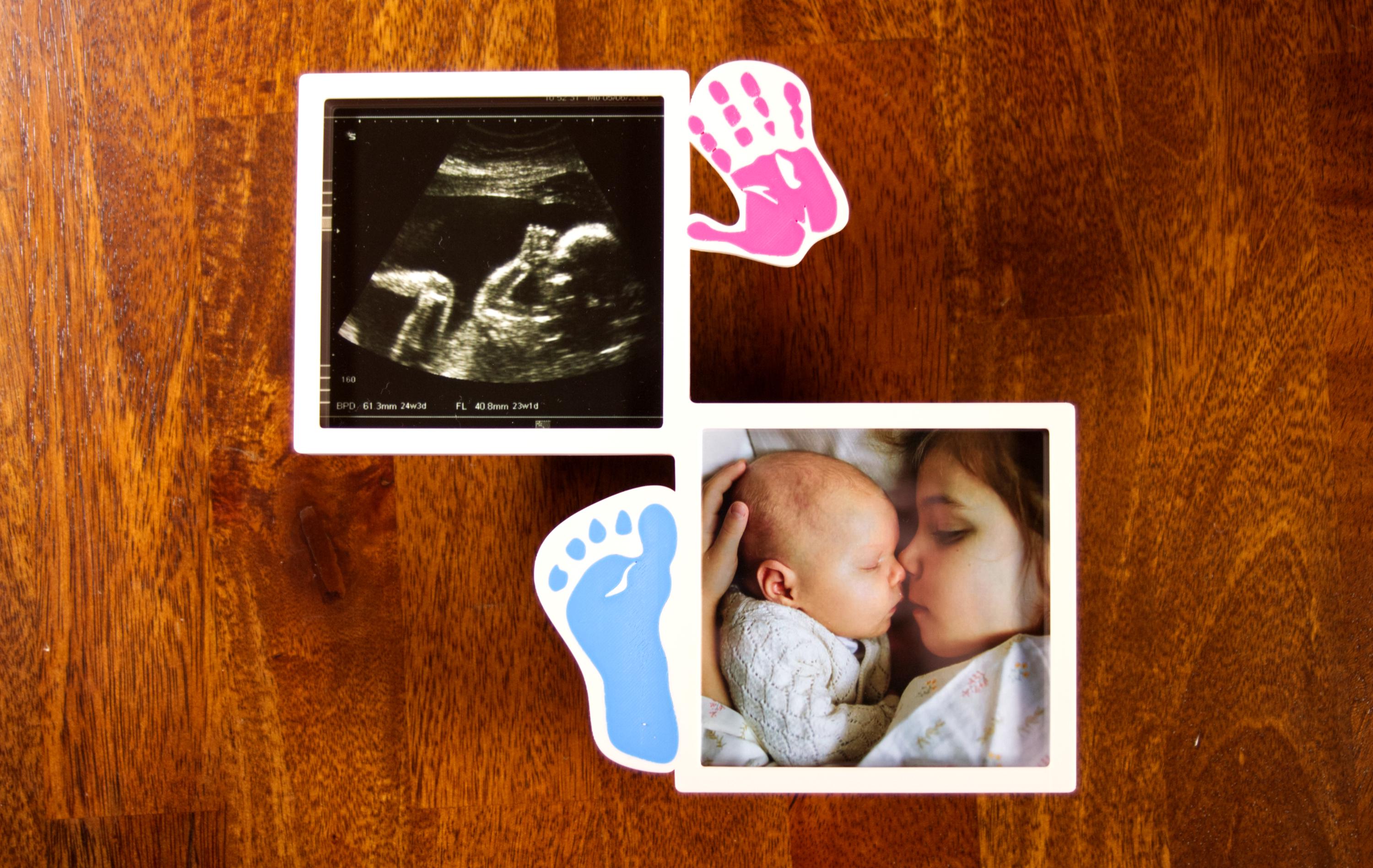 Customizable Ultrasound Handprint Footprint and 4x4 Magnetic Picture ...