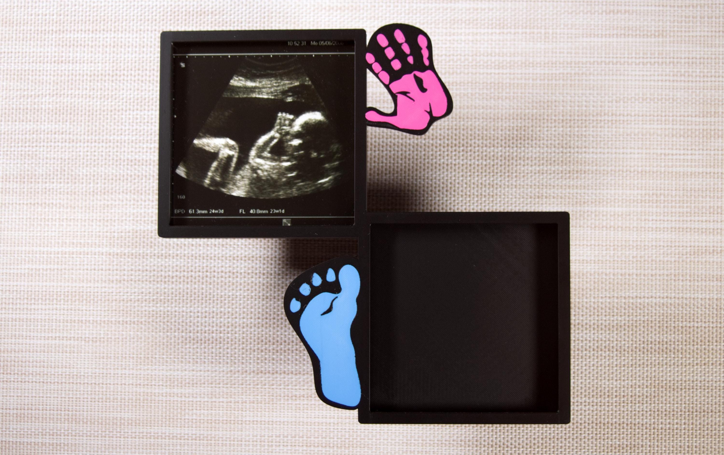 Customizable Ultrasound Handprint Footprint and 4x4 Magnetic Picture ...