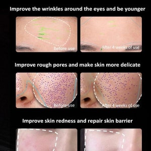 Vital Glow - LED Red Light Therapy Skin Mask - Reduce Dullness With ...