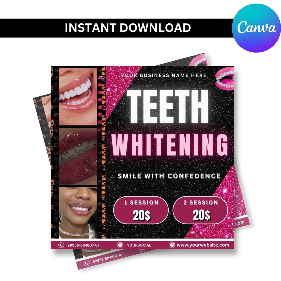 Teeth Whitening Flyer, Teeth Whitening Post, Teeth Whitening Marketing ...