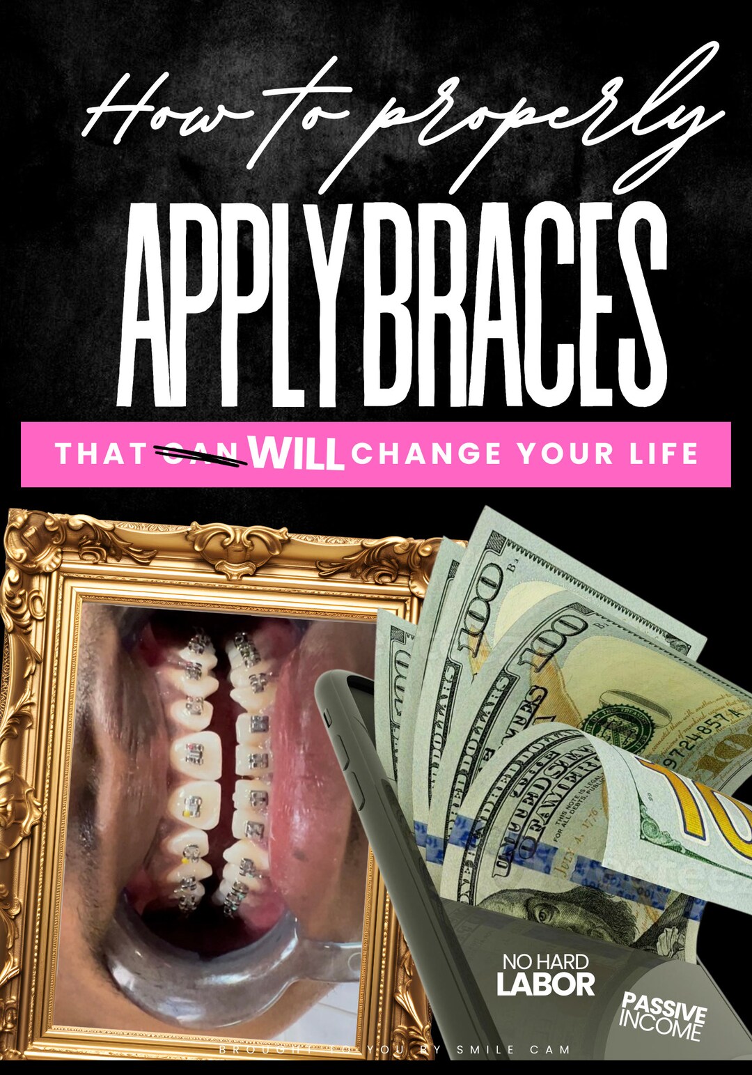 How to Properly Apply Braces Ebook - Etsy