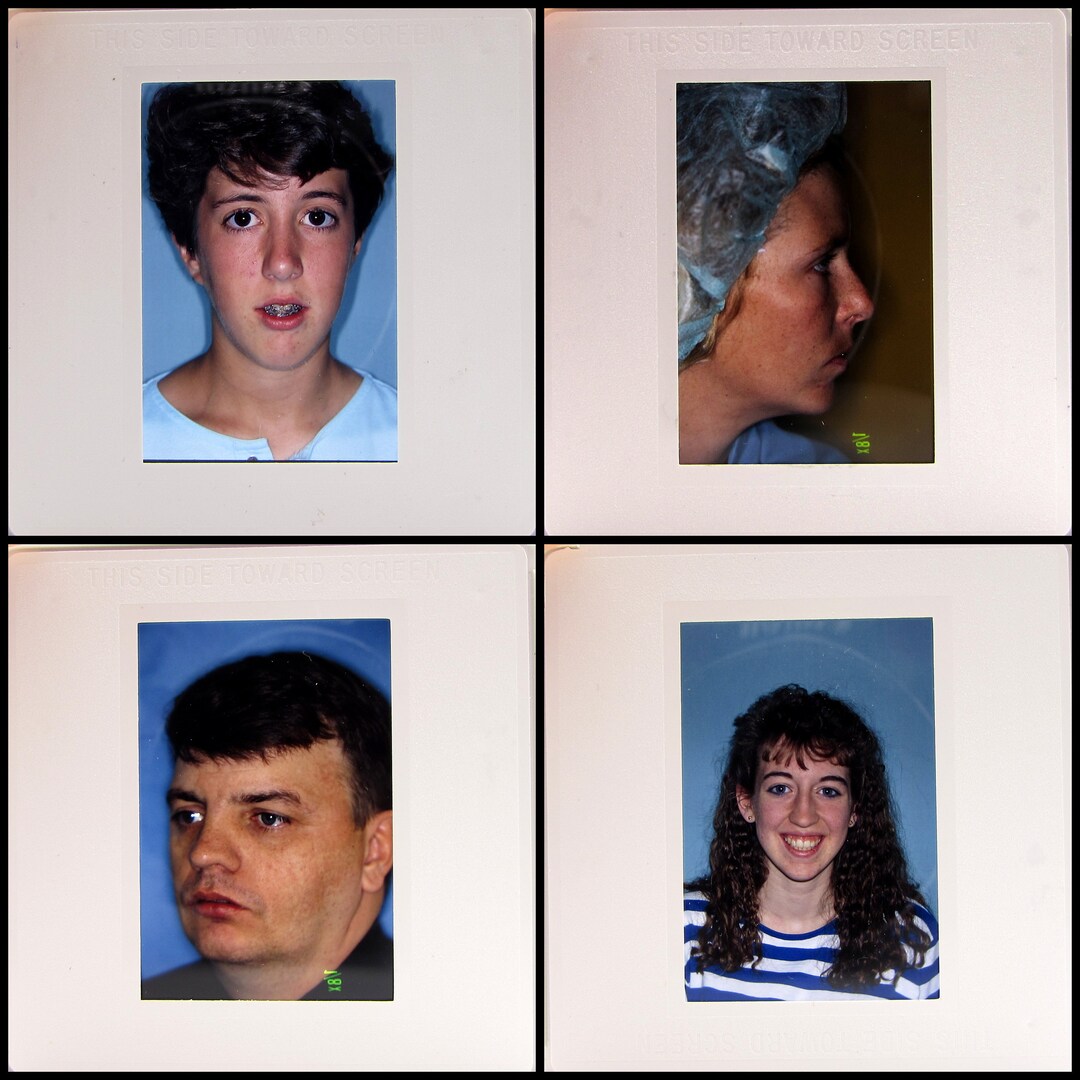 25 People Faces Slides - Vintage 35mm Photo Slides - Dental - Medical ...