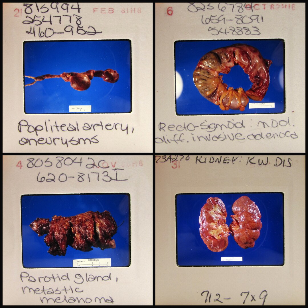 25 Internal Organs Vintage Photo Slides - Human Anatomy - Vintage 35mm ...
