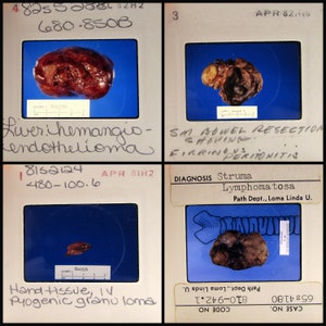 25 Internal Organs Vintage Photo Slides - Human Anatomy - Vintage 35mm ...