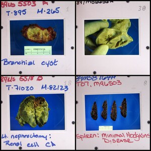 25 Internal Organs Vintage Photo Slides Human Anatomy Vintage 35mm ...