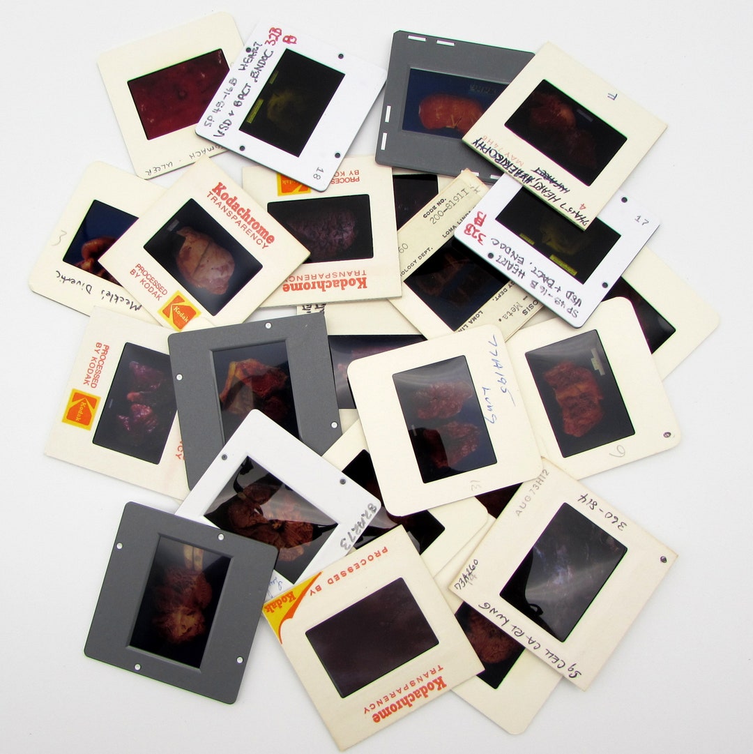 24 Internal Organs Vintage Photo Slides Human Anatomy Vintage 35mm ...