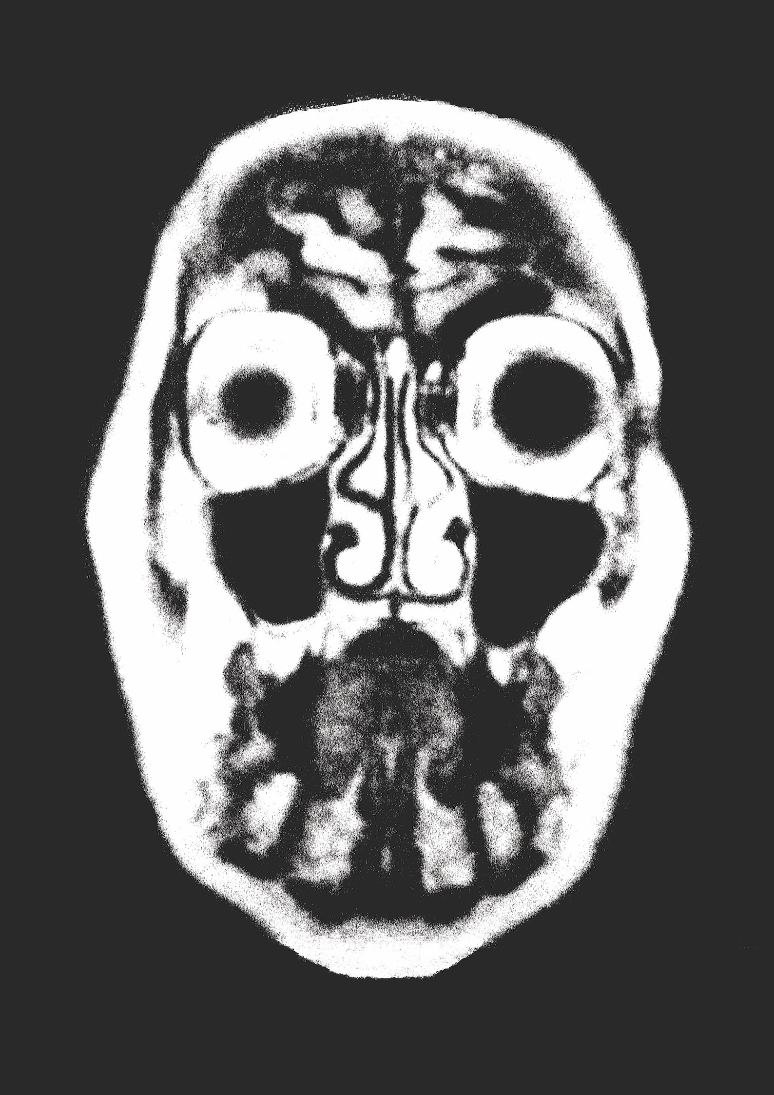 MRI Head Digital Print - Etsy