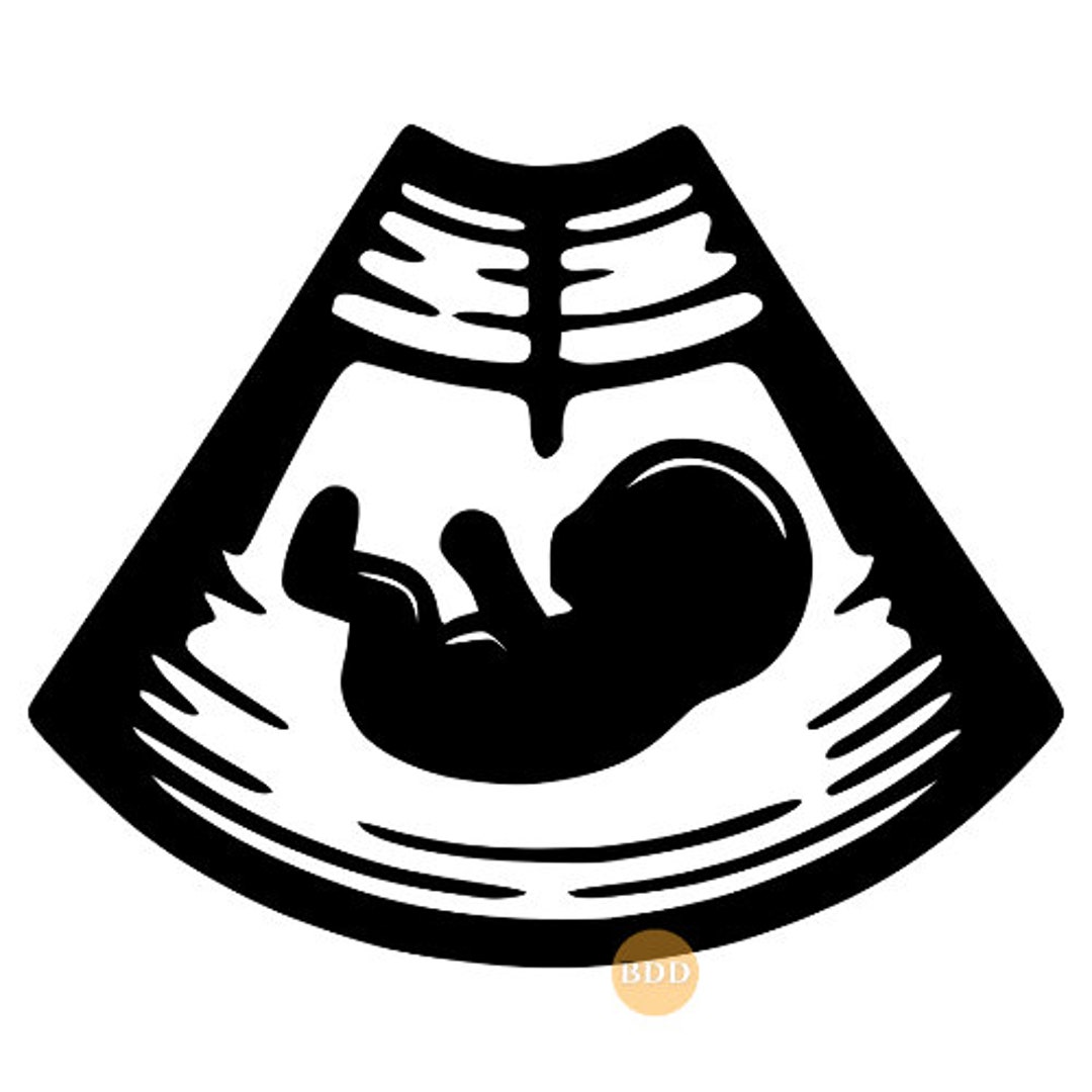 Baby Sonogram SVG,PNG - Etsy