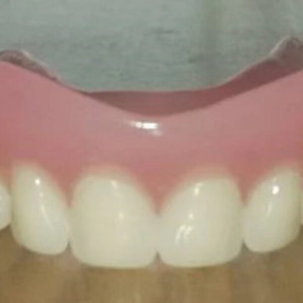 Upper and Lower Dentures - Etsy