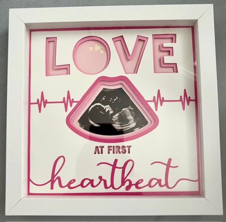Love at First Heartbeat Shadow Box - Etsy