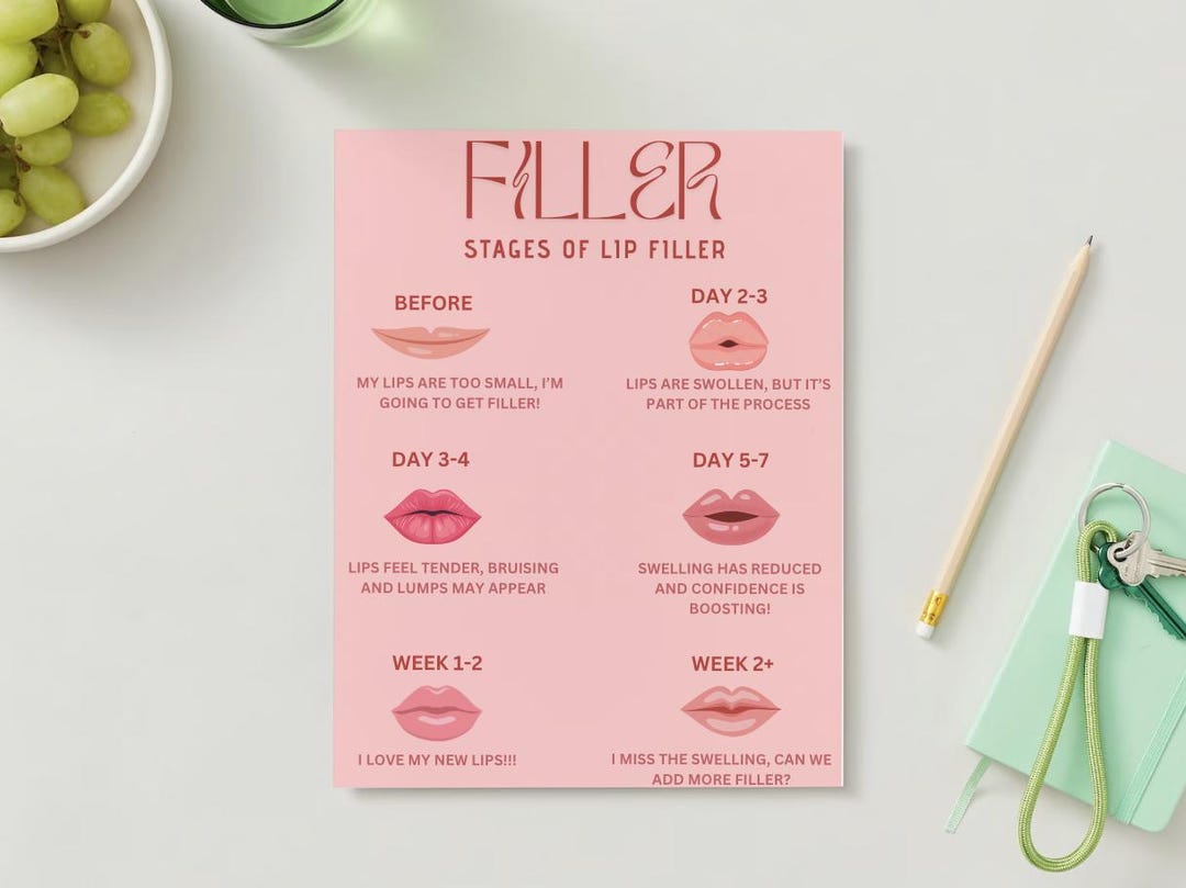 Stages of Lip Filler, Lip Filler Journey, Printable Art, Beauty Sign ...
