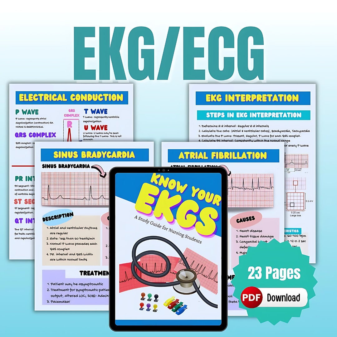 EKG Study Guide for Nursing Student, EKG Arrhythmias, ECG, Nursing ...