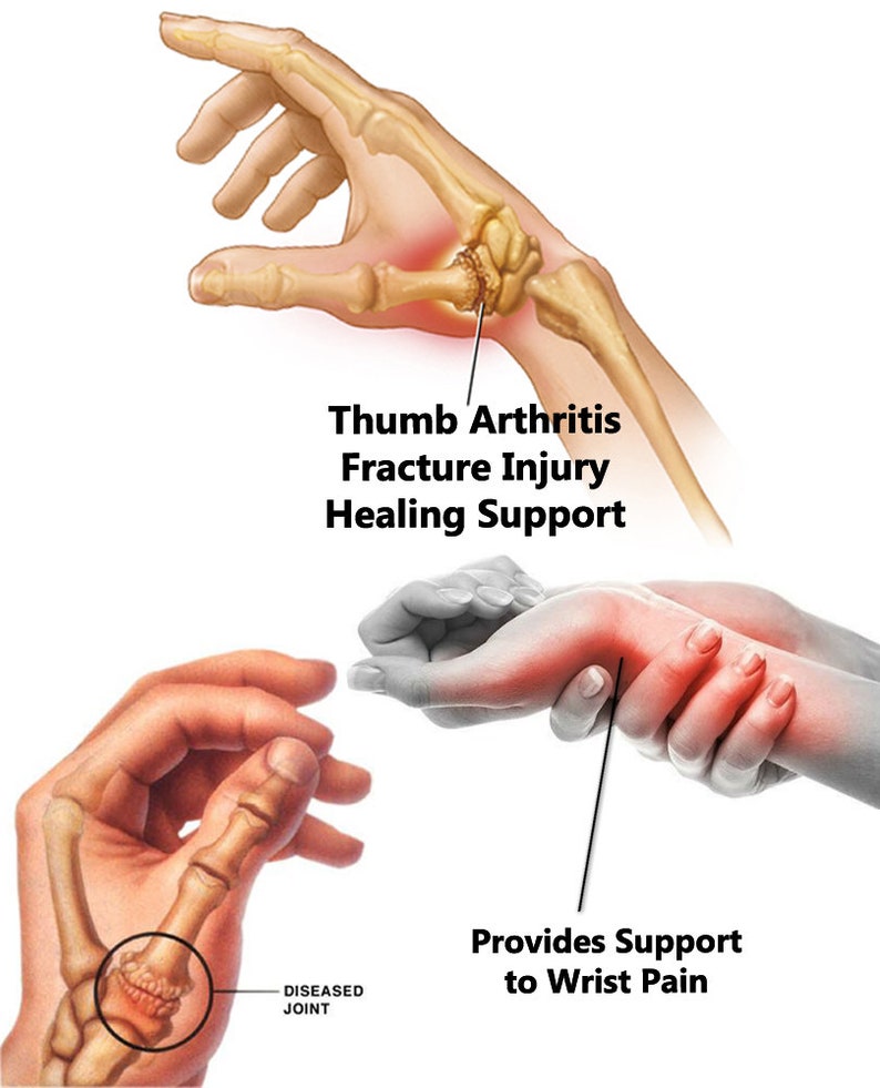 Neoprene Thumb Support Splint Spica Brace Wrist Hand Strain Sprain ...