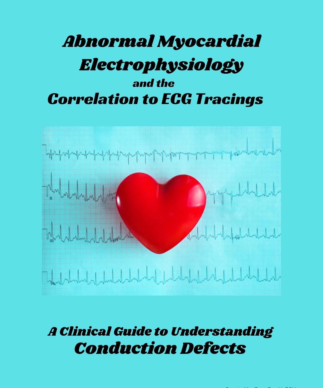 Abnormal Myocardial Electrophysiology / Impaired Cardiac Conduction ...