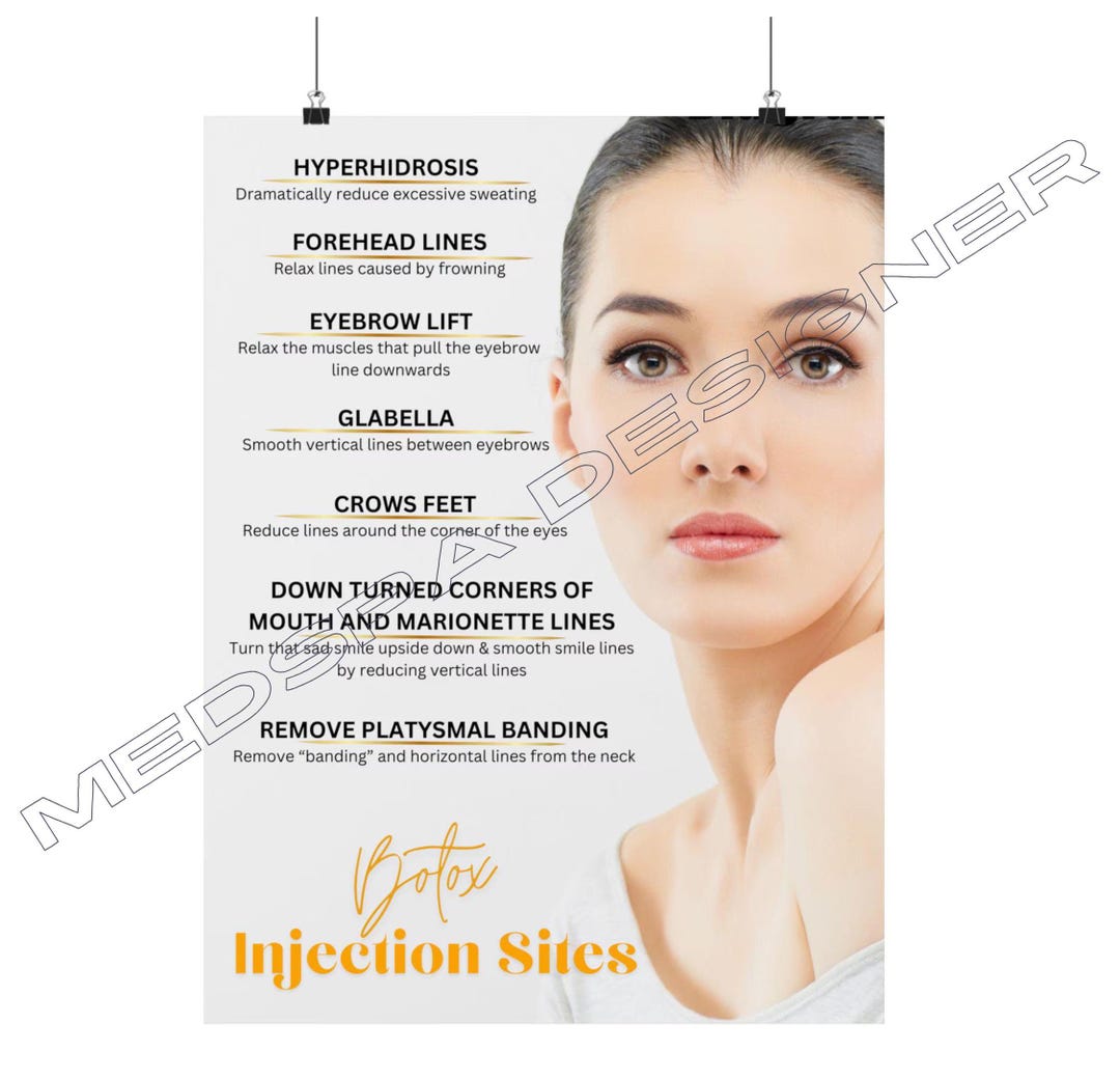 Botox Injection Sites Poster, Botox Benefits Esthetician Consultation ...
