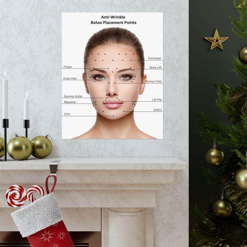 Customized With Logo Anti-wrinkle Botox Placement Points Poster, Medspa ...
