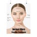 Dermal Filler Possible Treatments Poster, Medspa Nurse Injector Decor ...