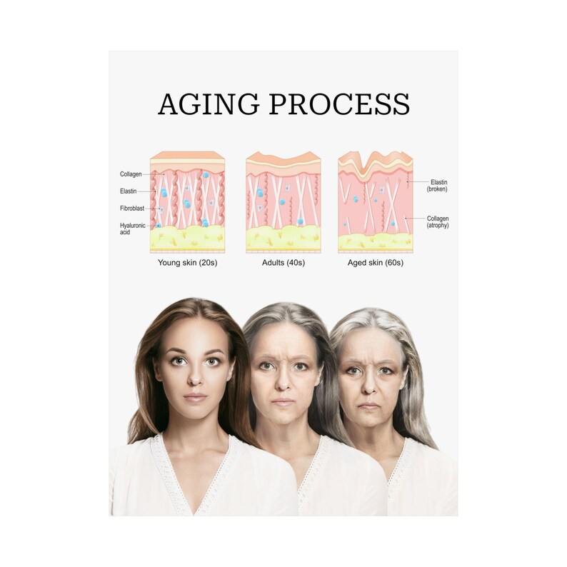 Aging Process Skin Changes Stages Matte Vertical Poster, Plastic ...