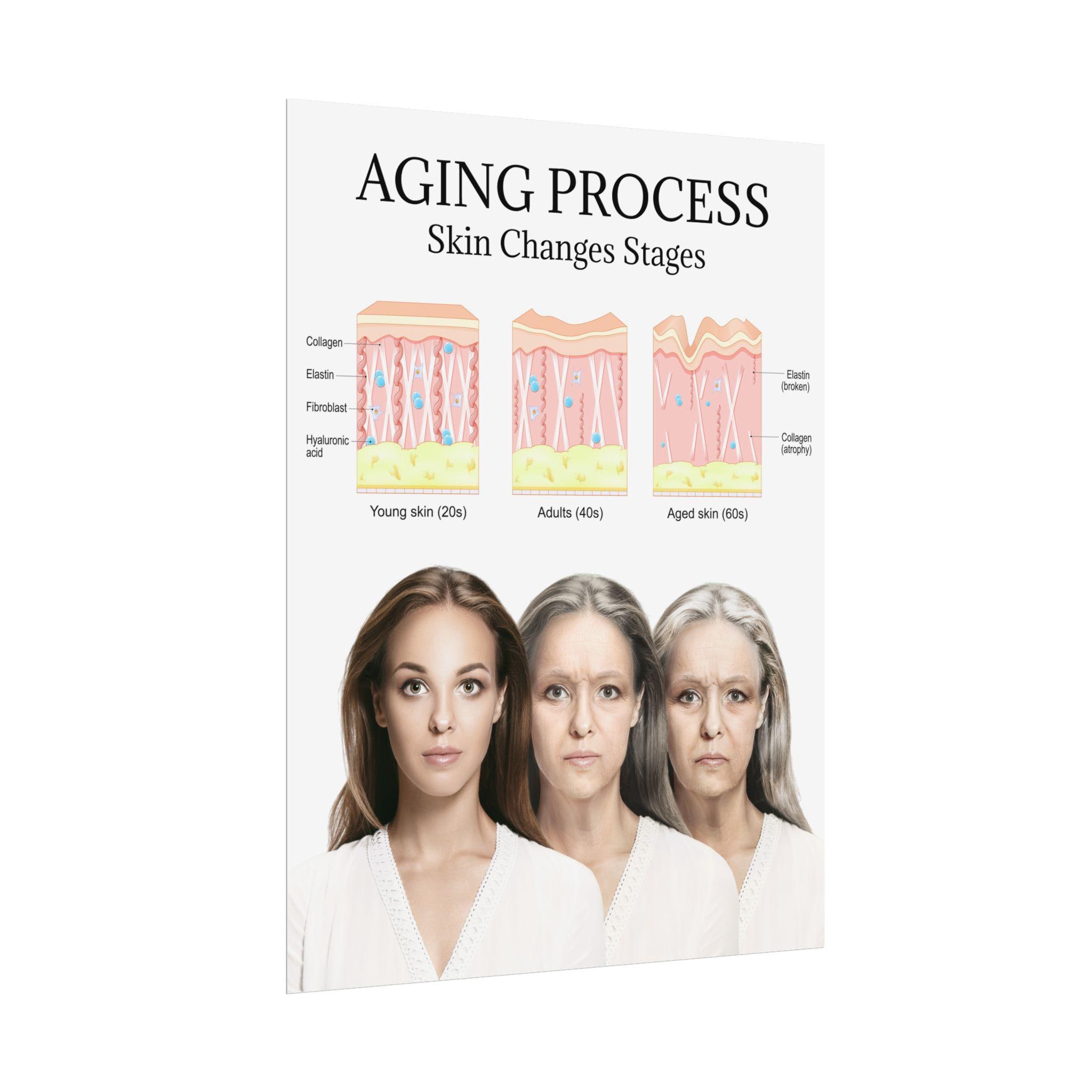 Aging Process Skin Changes Stages Rolled Poster, Face Lift Med Spa ...