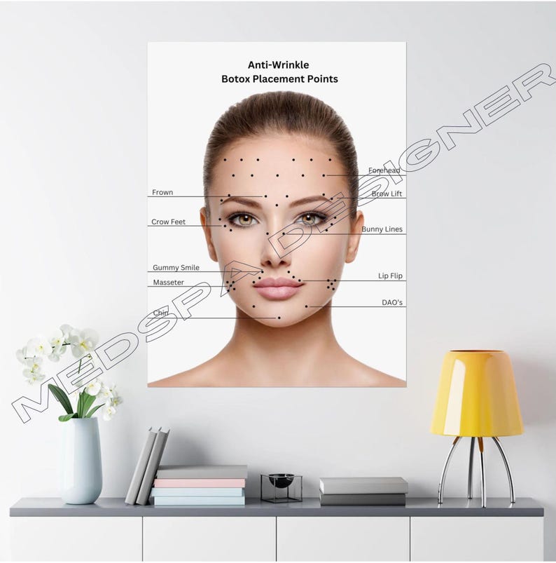 Customized With Logo Anti-wrinkle Botox Placement Points Poster, Medspa ...