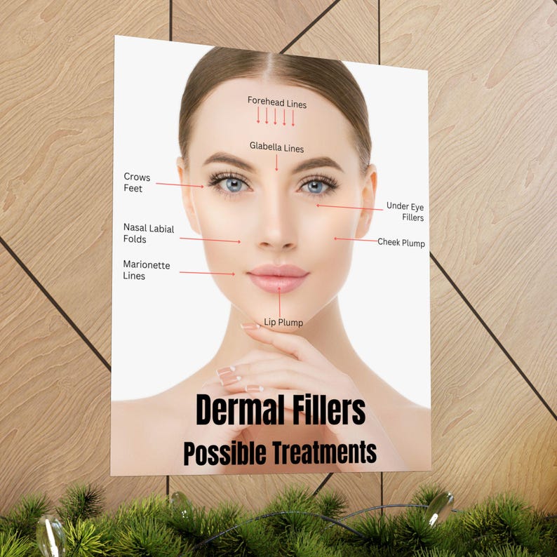 Dermal Filler Possible Treatments Poster, Medspa Nurse Injector Decor ...
